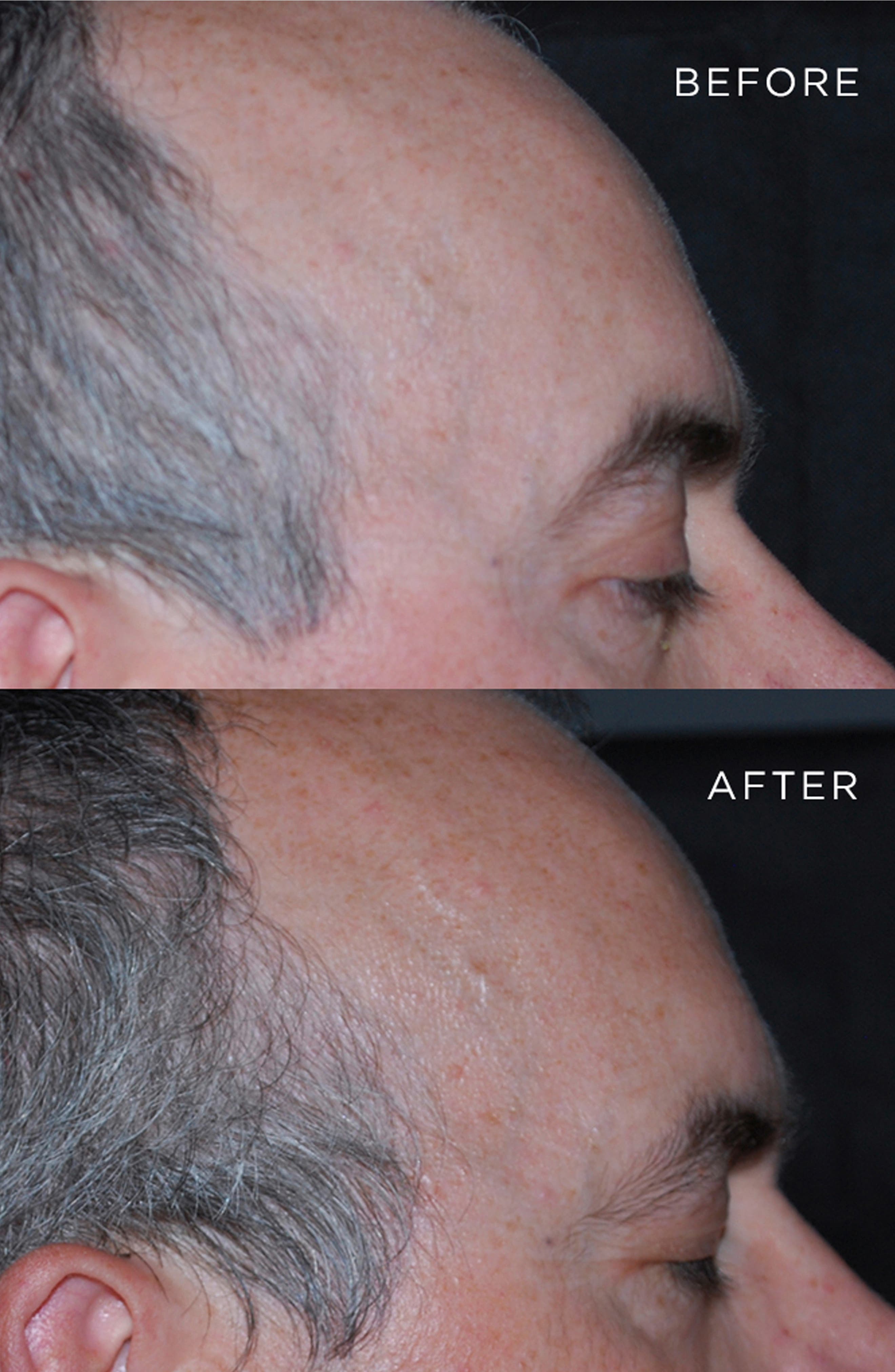 PHYTO RE30 Anti-Grey Hair Treatment | Nordstrom