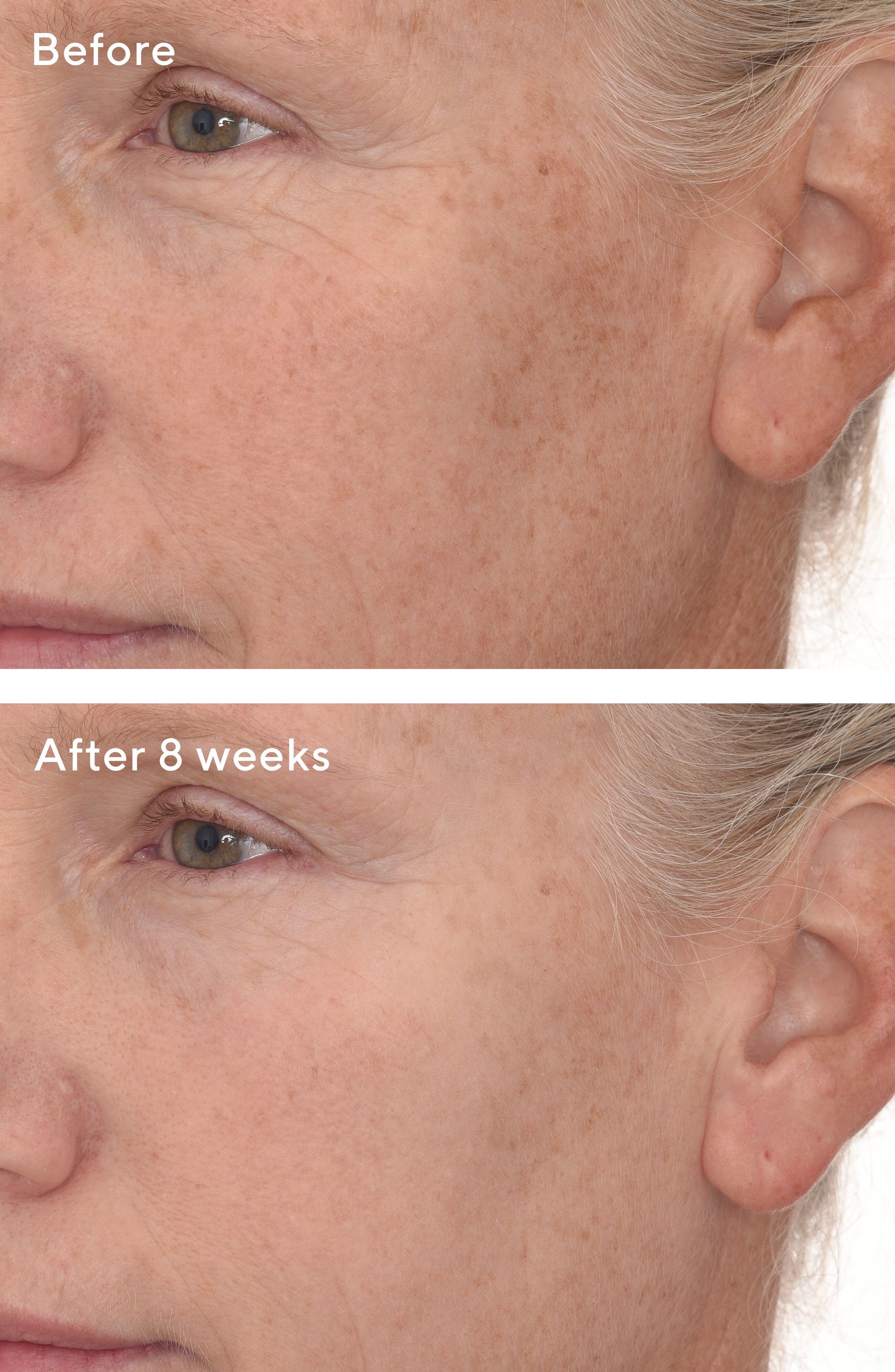 Murad® Resurgence™ Retinal ReSculpt™ Overnight Treatment | Nordstrom