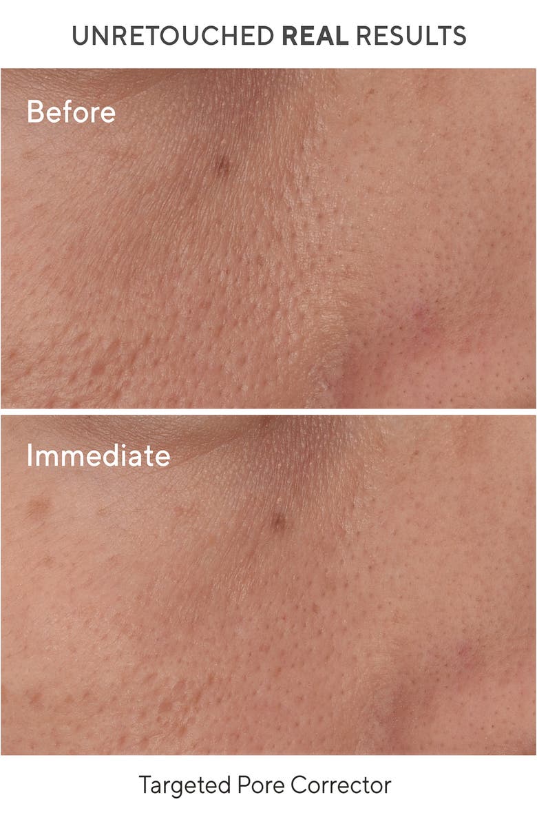 Murad® Targeted Pore Corrector | Nordstrom