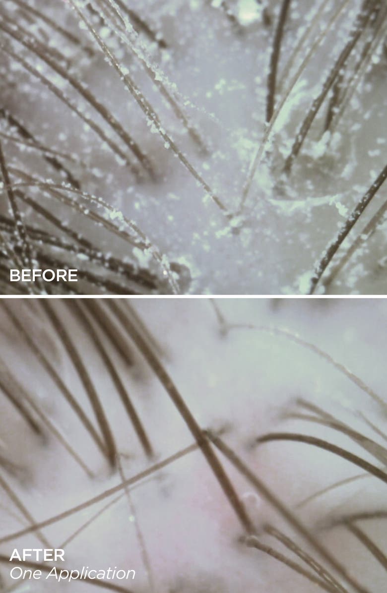 BeautyBio Healthy Scalp Serum Hair Density Treatment | Nordstrom