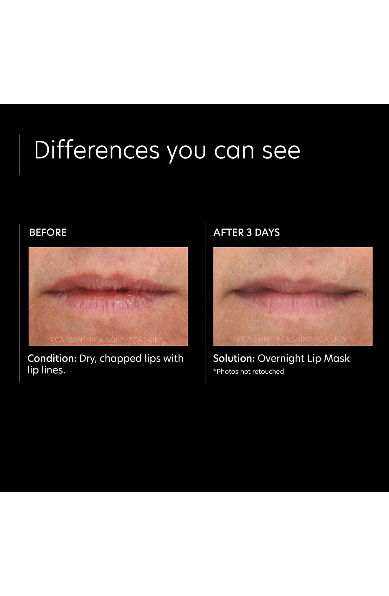 PCA Skin Overnight Lip Mask | Nordstrom