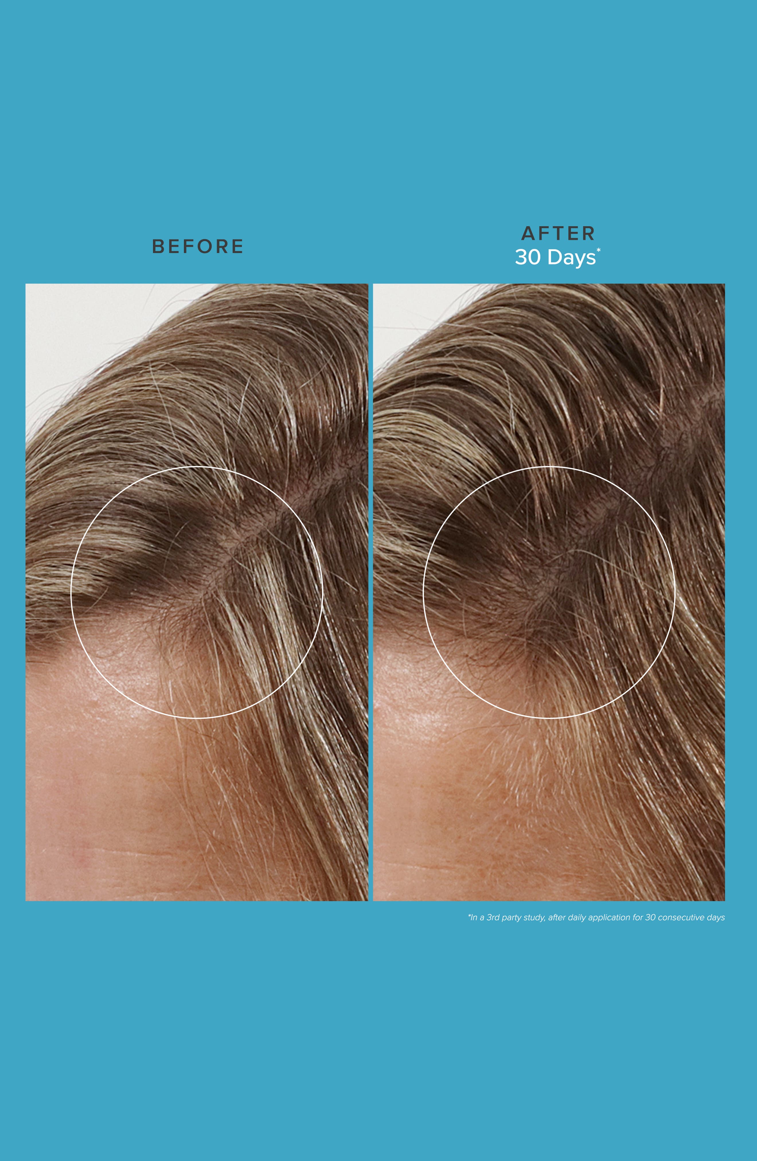 Living proof® Scalp Care Revitalizing Treatment | Nordstrom