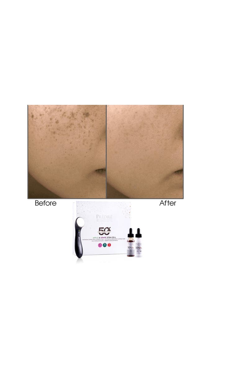 PREDIRE PARIS 50X Apple & Grape Stem Cell Intensive Day & Night Dark ...