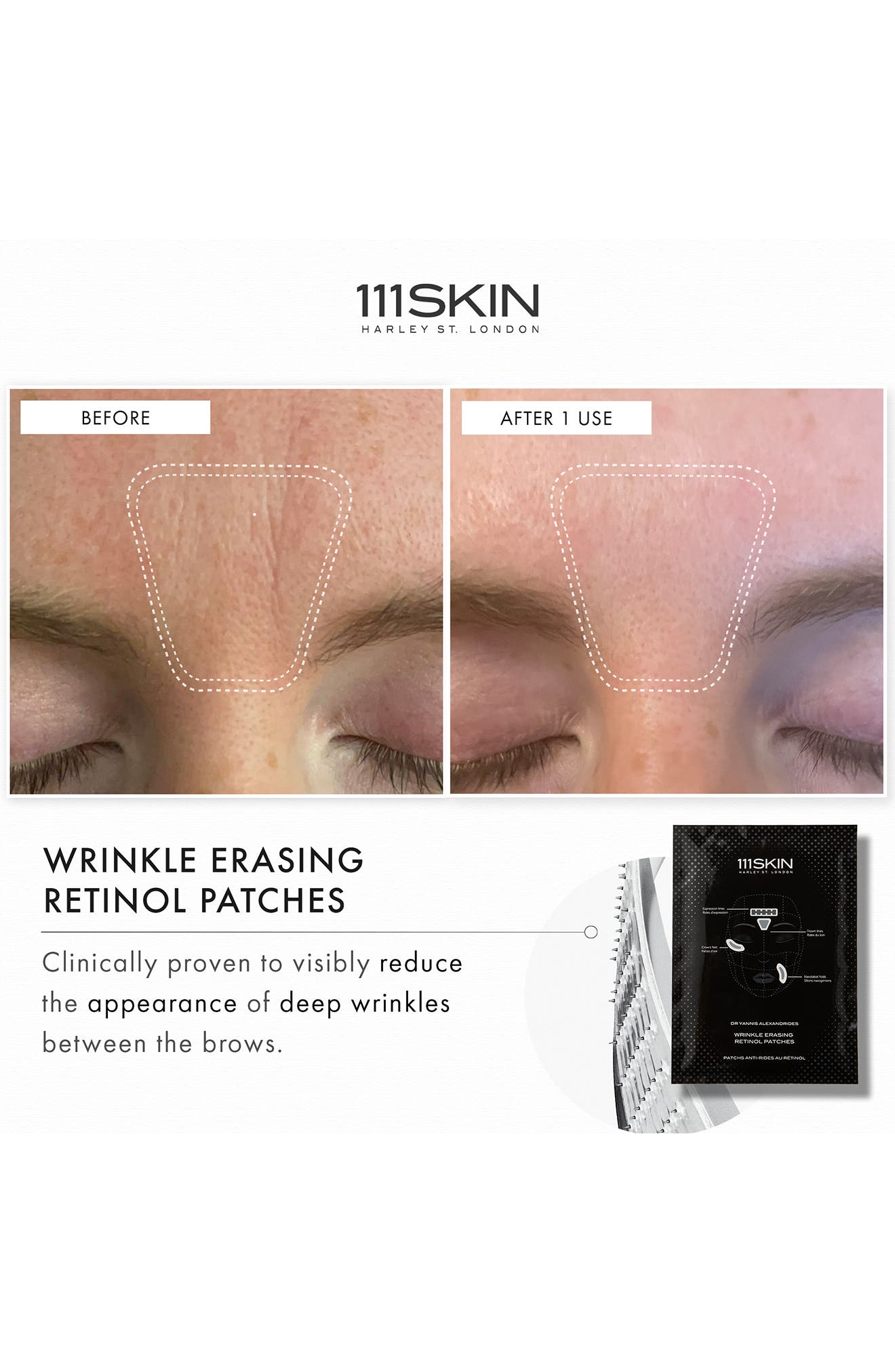 111SKIN Wrinkle Erasing Retinol Patch | Nordstrom
