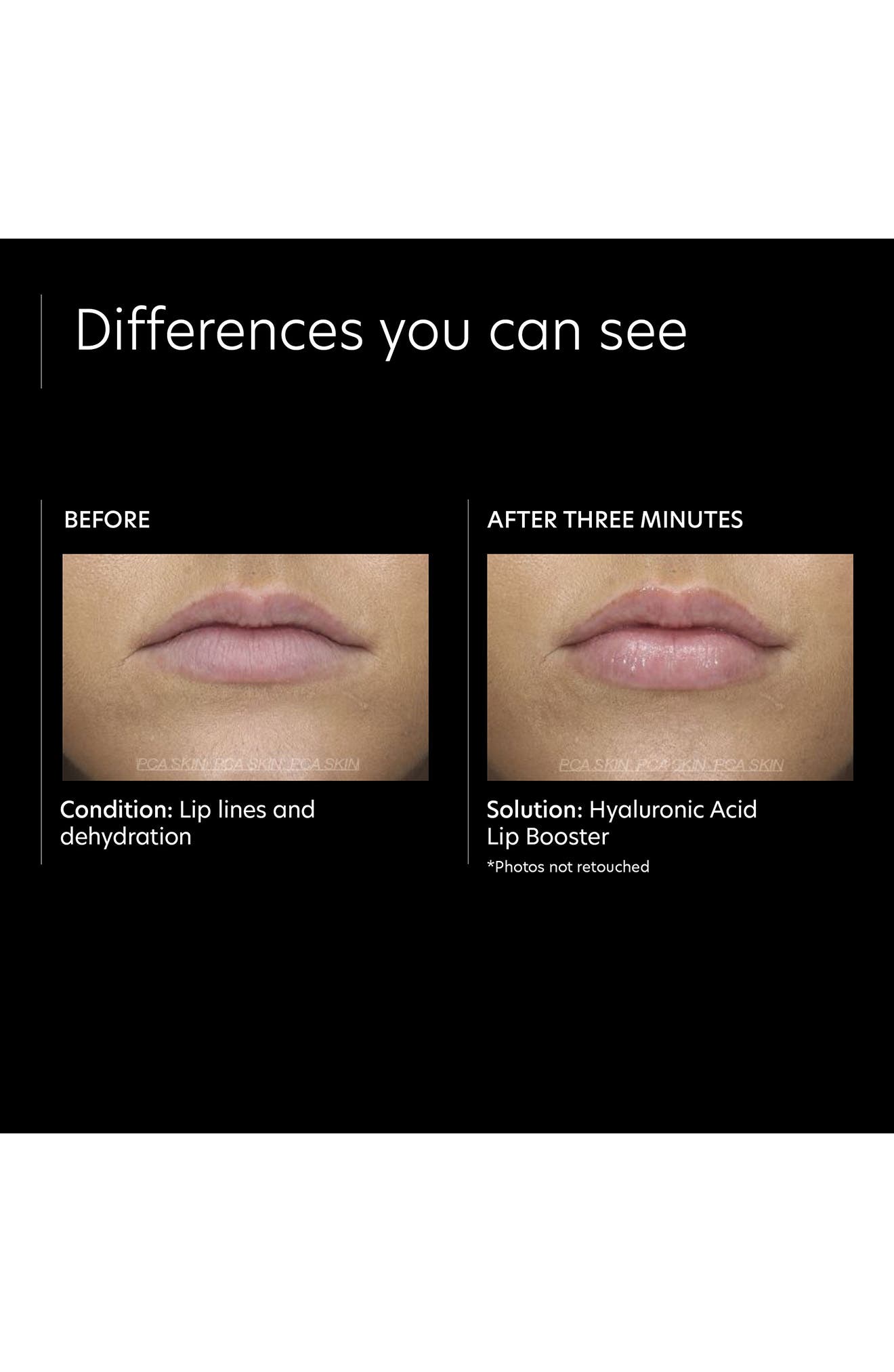 PCA Skin Hyaluronic Acid Lip Booster | Nordstrom