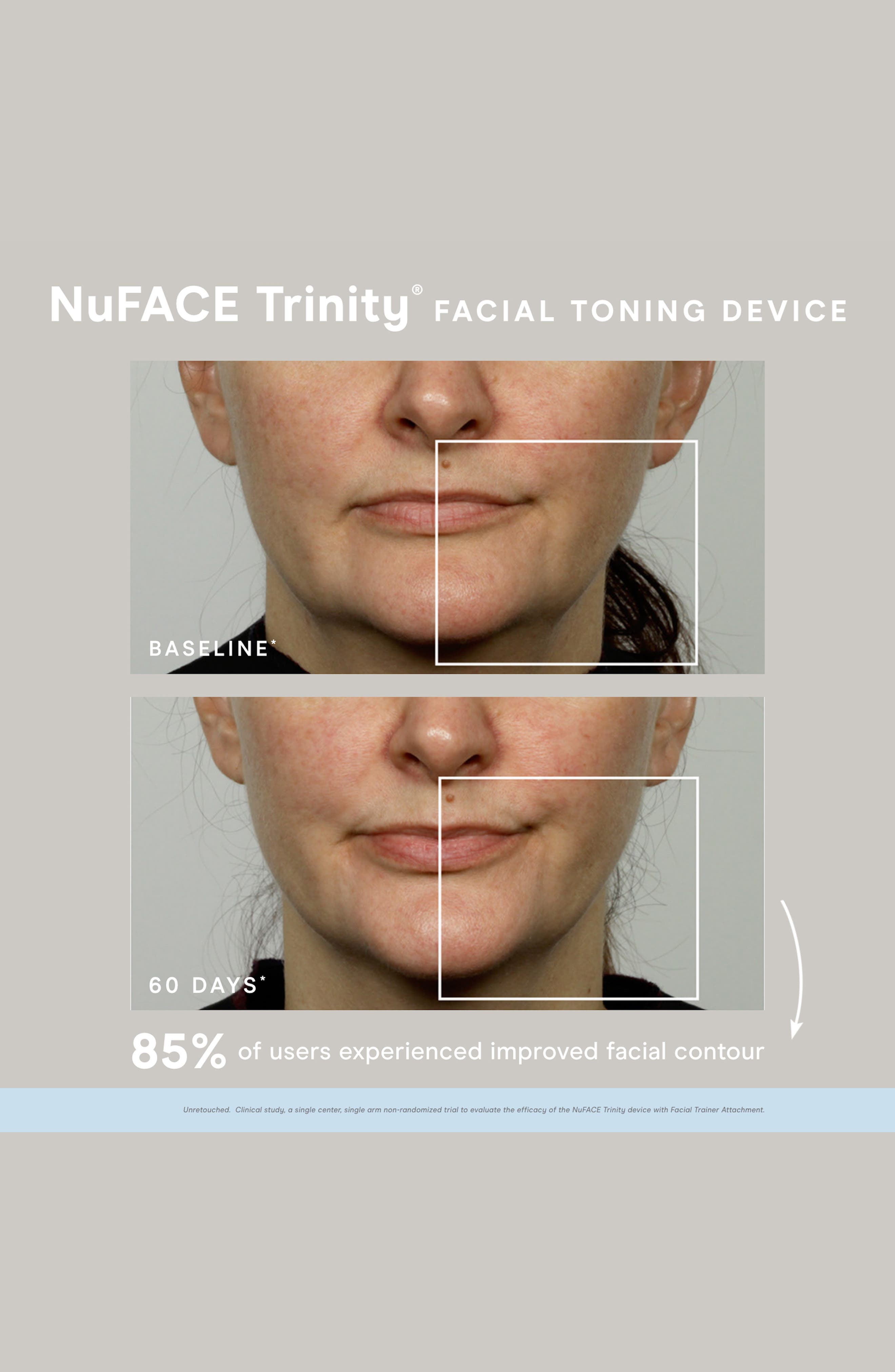 NuFACE® Trinity® Skin Care Regimen Set (Limited Edition) USD $473 Value ...