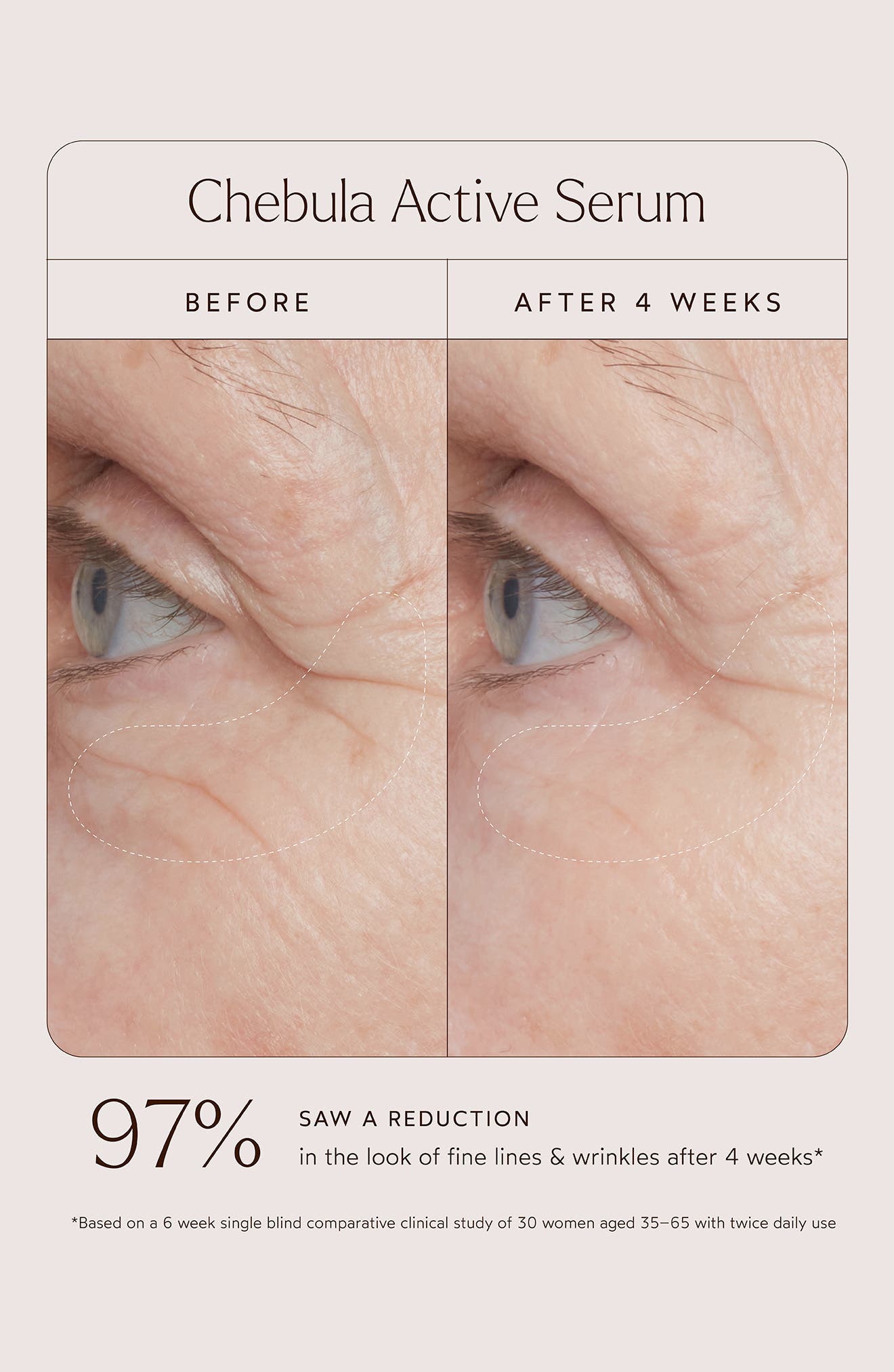 True Botanicals Chebula Active Anti-Aging Serum | Nordstrom