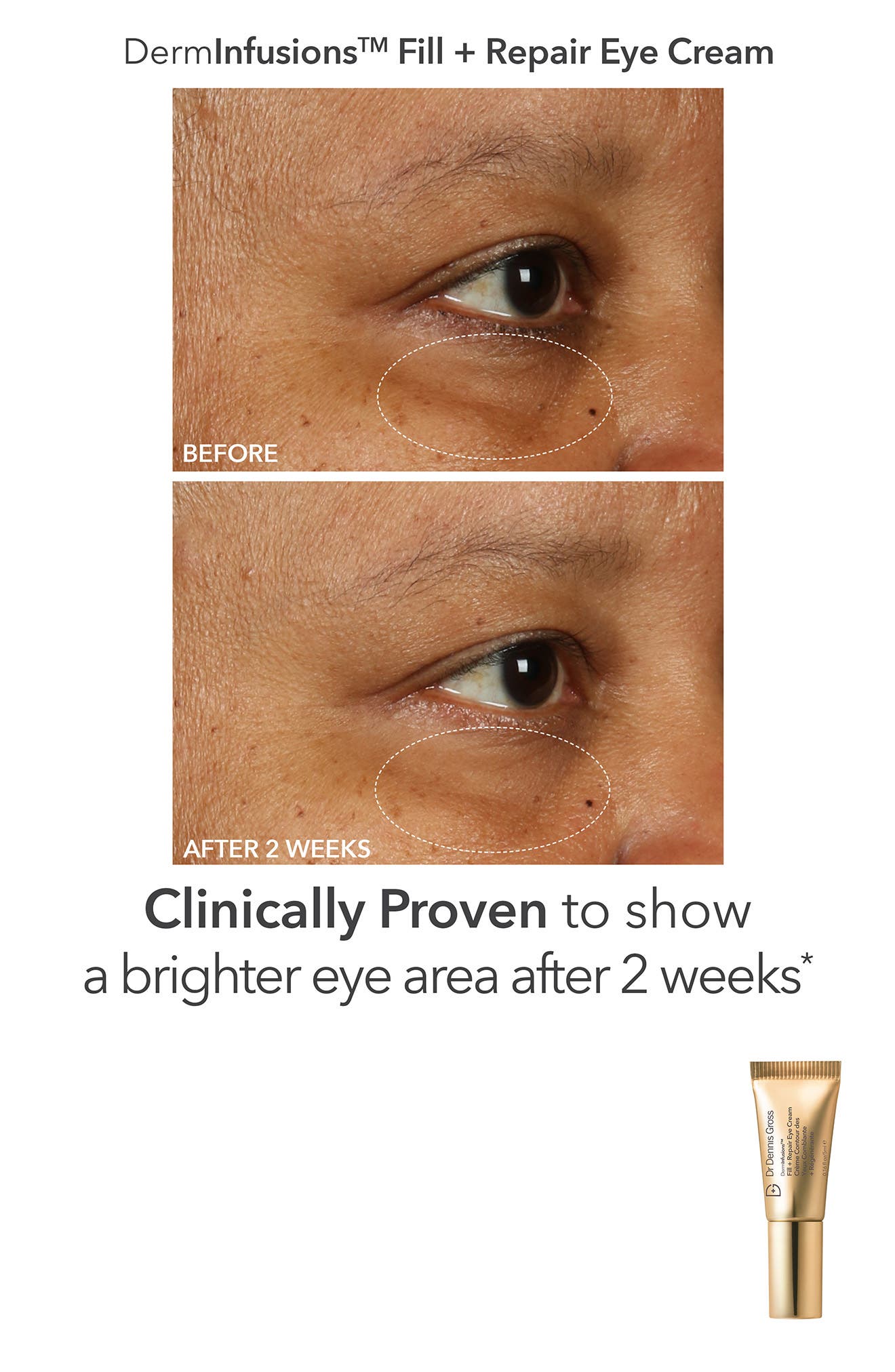Dr. Dennis Gross Skincare Fill, Plump & Firm Set $123 Value | Nordstrom