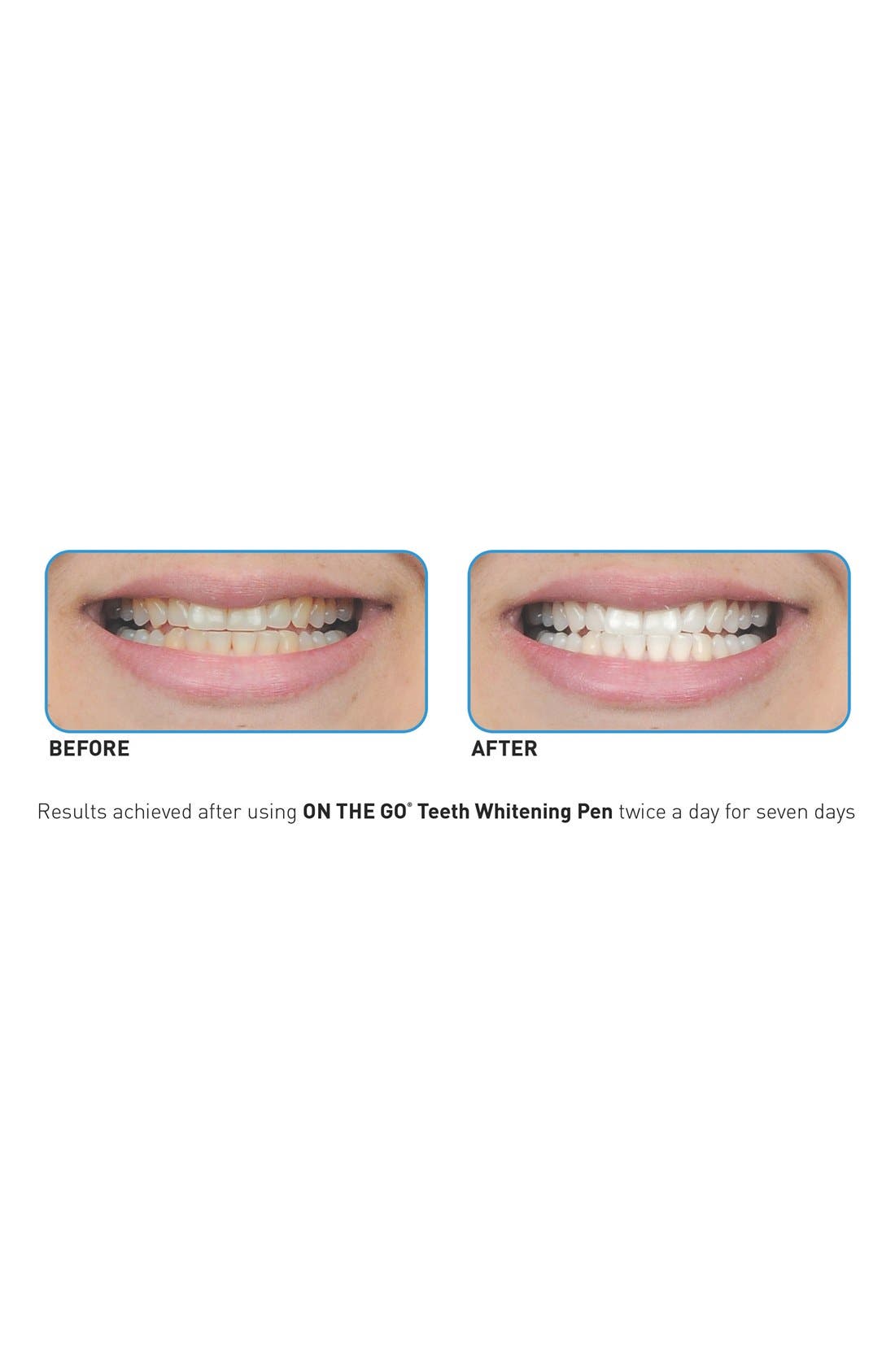 GO SMiLE® 'On the Go®' Teeth Whitening Pen | Nordstrom