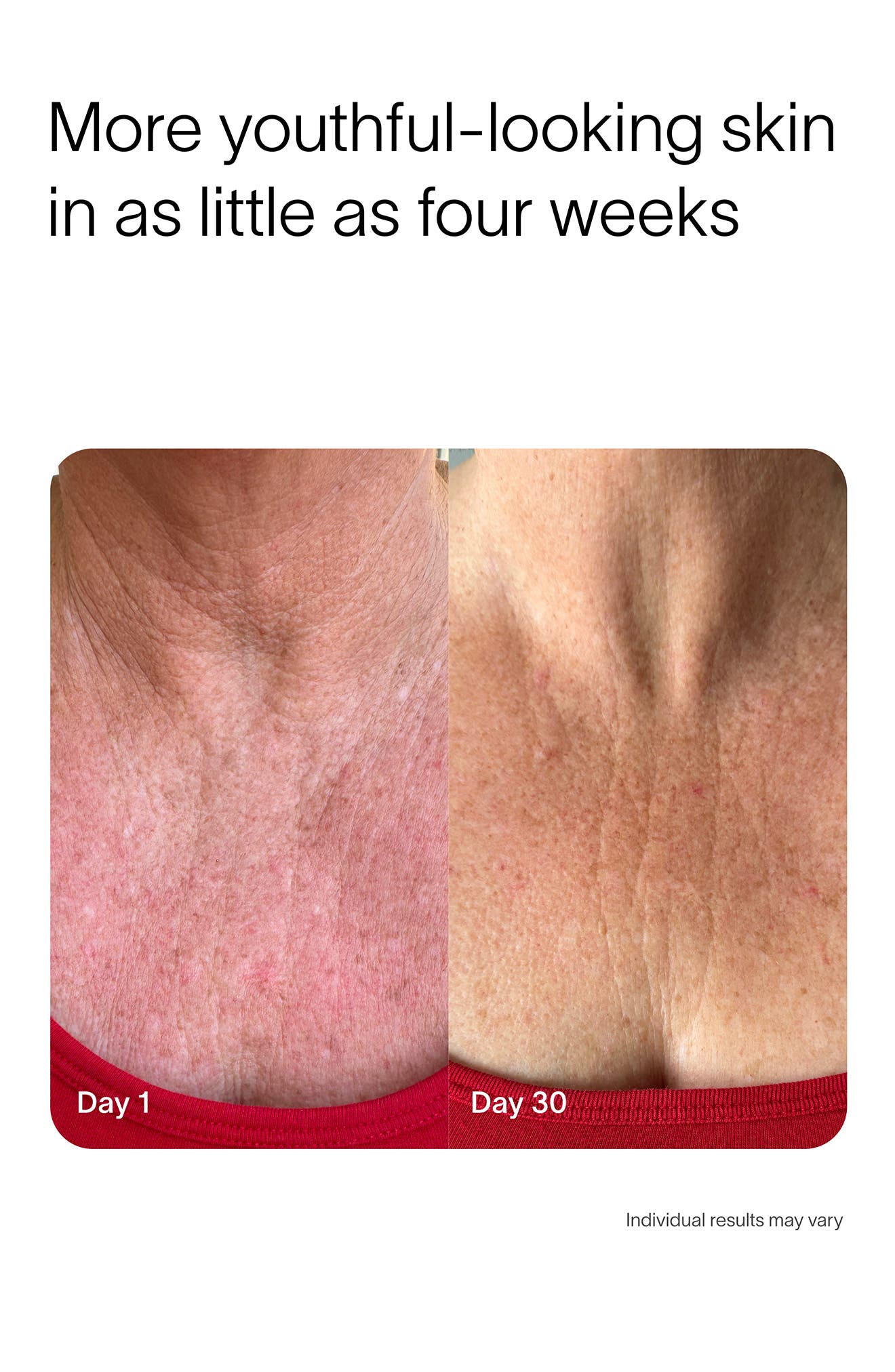 SolaWave Neck & Chest Rejuvenating Red Light Therapy Mask | Nordstrom