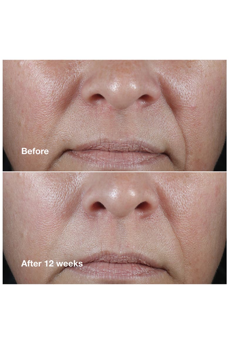 Smart Clinical Repair Wrinkle Correcting Rich Face Cream (Women ...