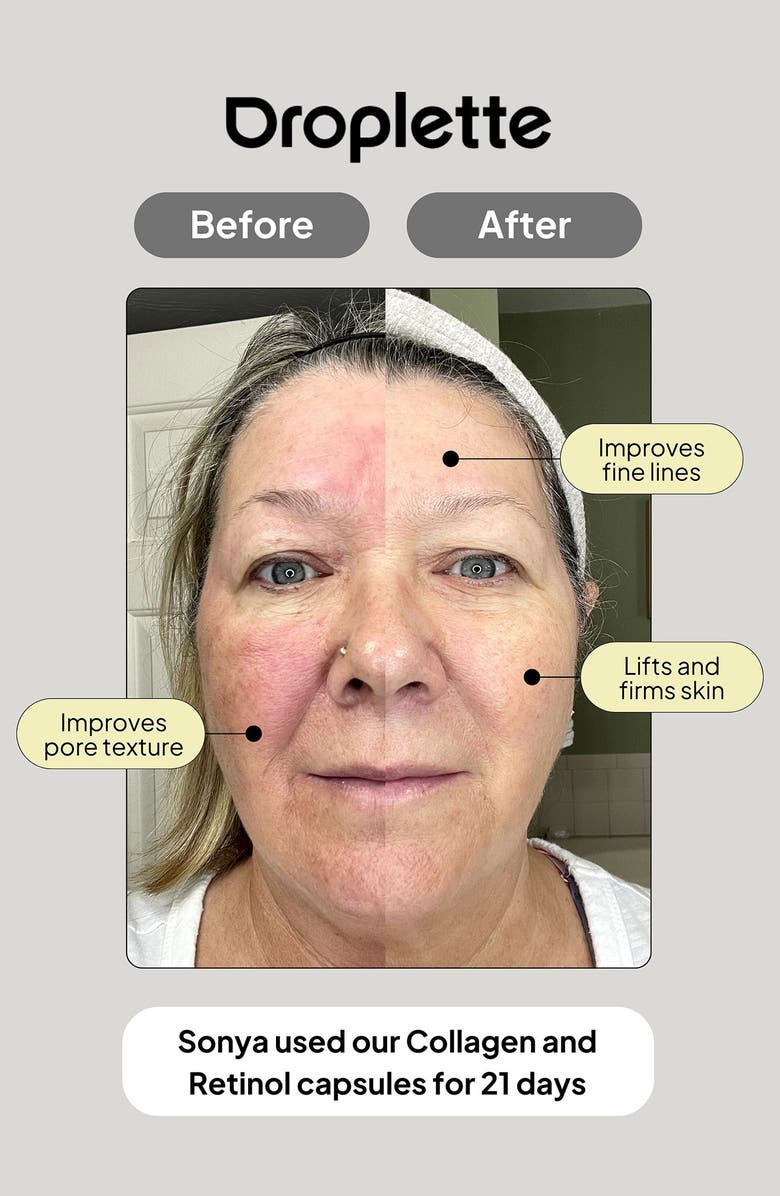 Droplette 2 Device Set with Deluxe Collagen Hydrofiller & Mini Retinol ...