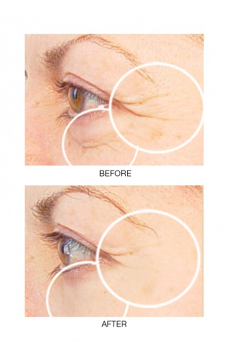 MIRENESSE Power Lift Superstar Eye Sheet 6-Piece Set | Nordstromrack