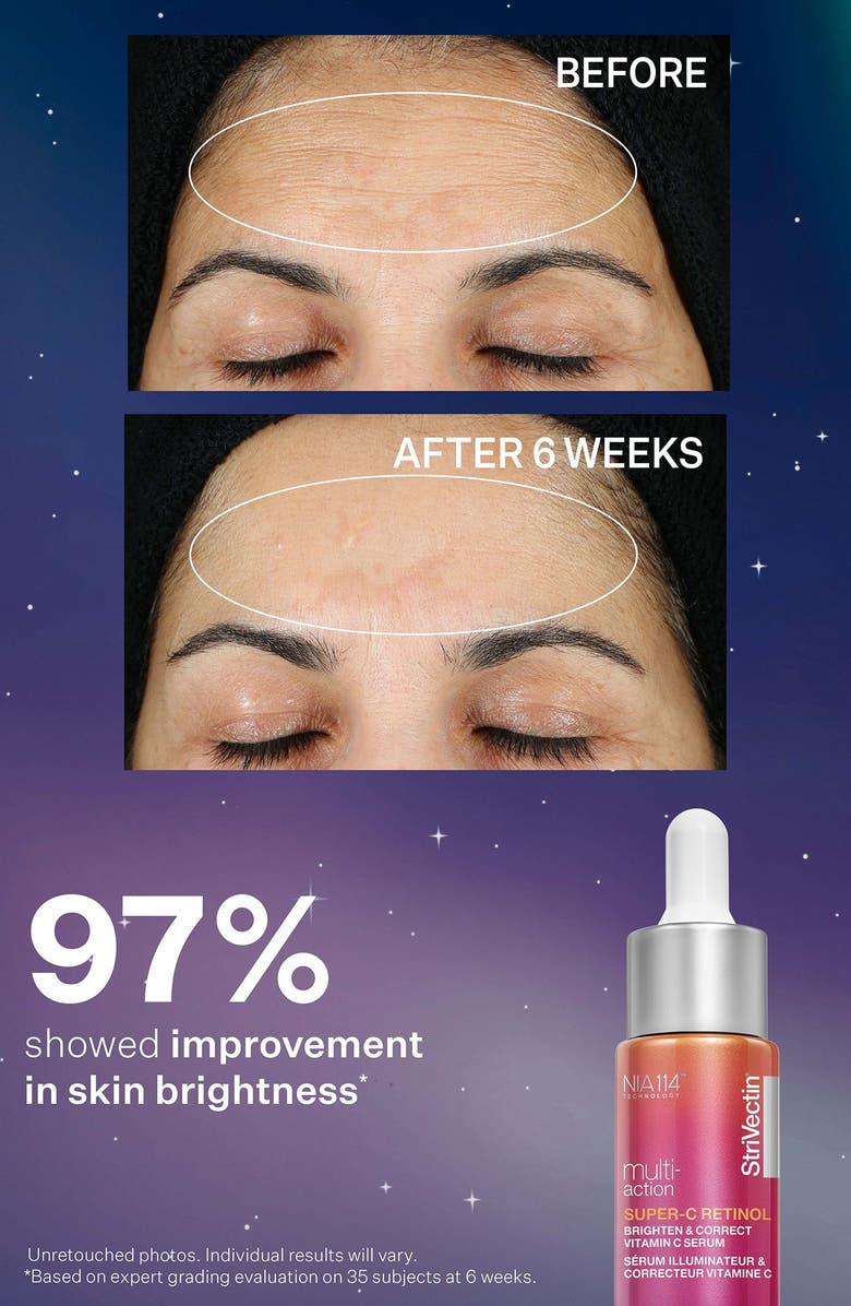 StriVectin® Brighten & Rejuvenate Super-C Holiday Set (Limited Edition ...