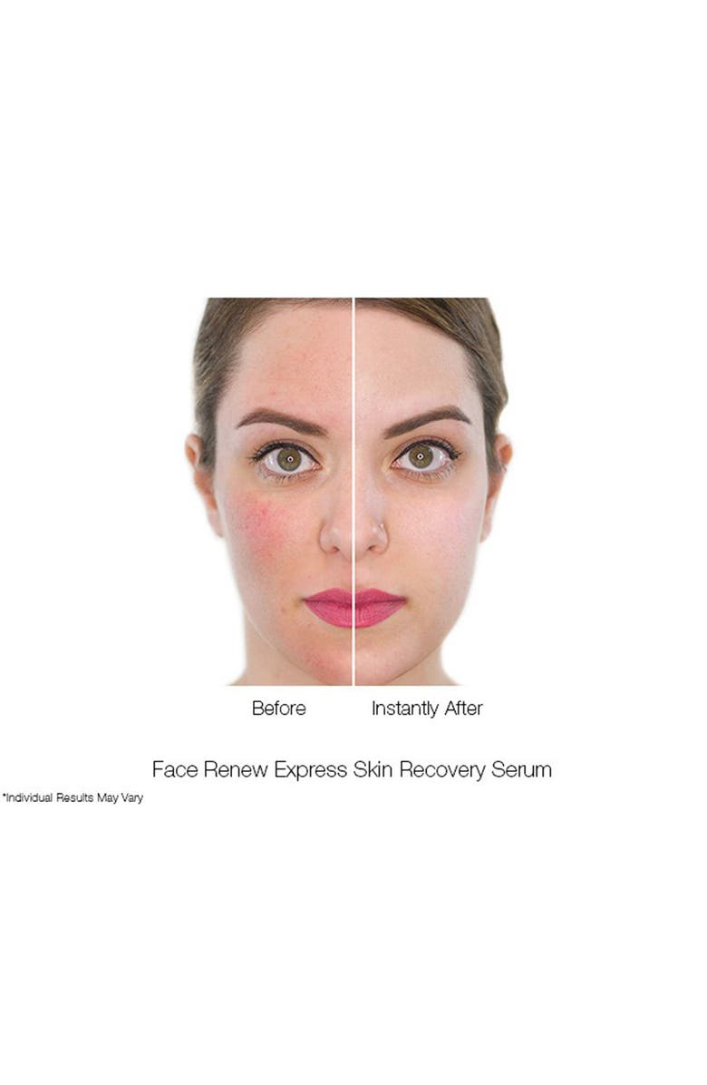 MIRENESSE Face Renew Express Skin Recovery Serum | Nordstromrack