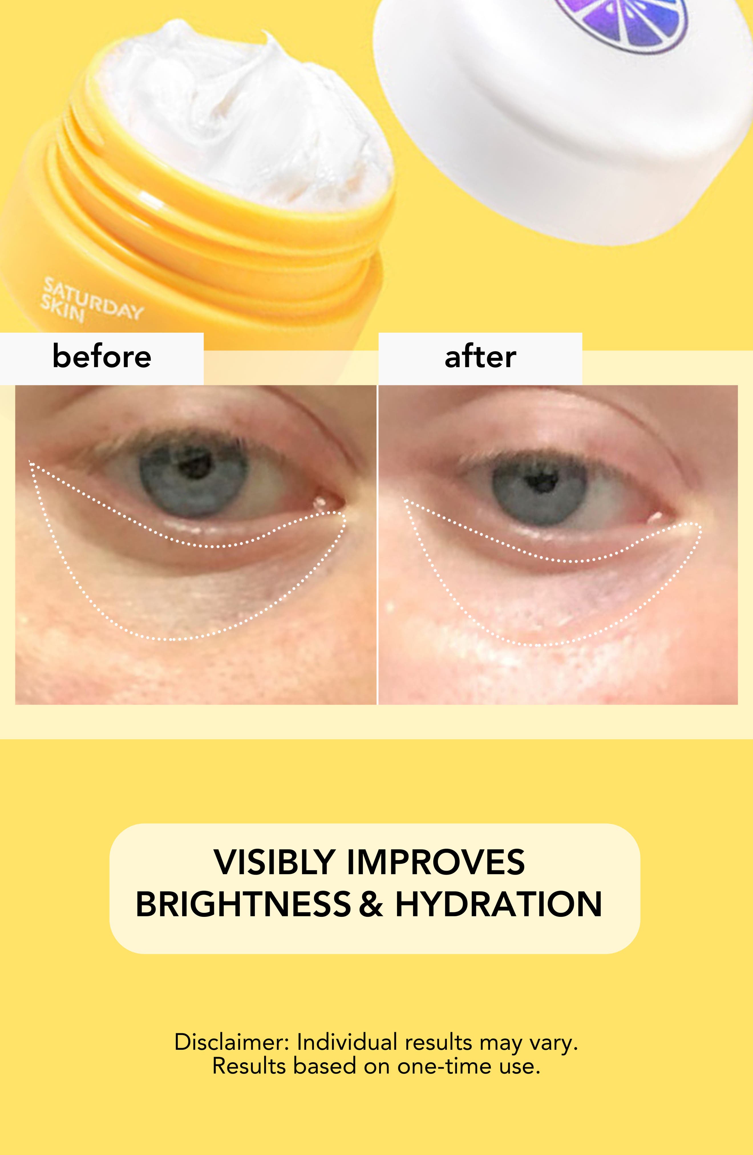 Saturday Skin Yuzu Vitamin C Bright Eye Cream | Nordstrom